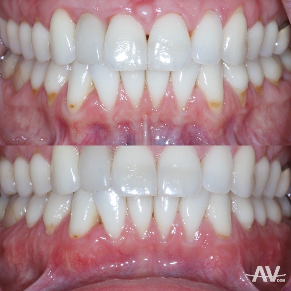 ANDREW VERRETT- AUSTIN PERIODONTAL ASSOCIATES - Updated December 2025 ...