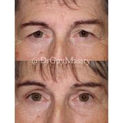 GUY MASSRY, MD - Updated December 2025 - 154 Photos & 175 Reviews - 150 ...