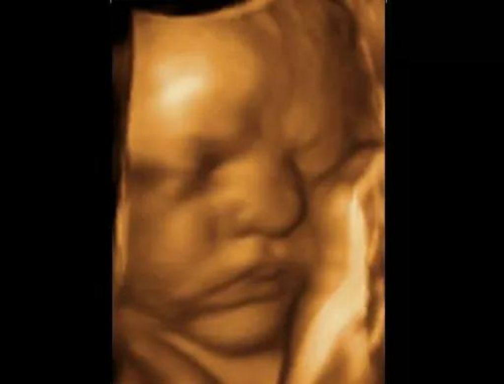 FETAL MEMORIES 2D 3D 4D ULTRASOUND - Updated September 2025 - 151 ...