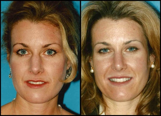 BARRY M. WEINTRAUB MD - Updated October 2025 - 64 Photos & 101 Reviews ...