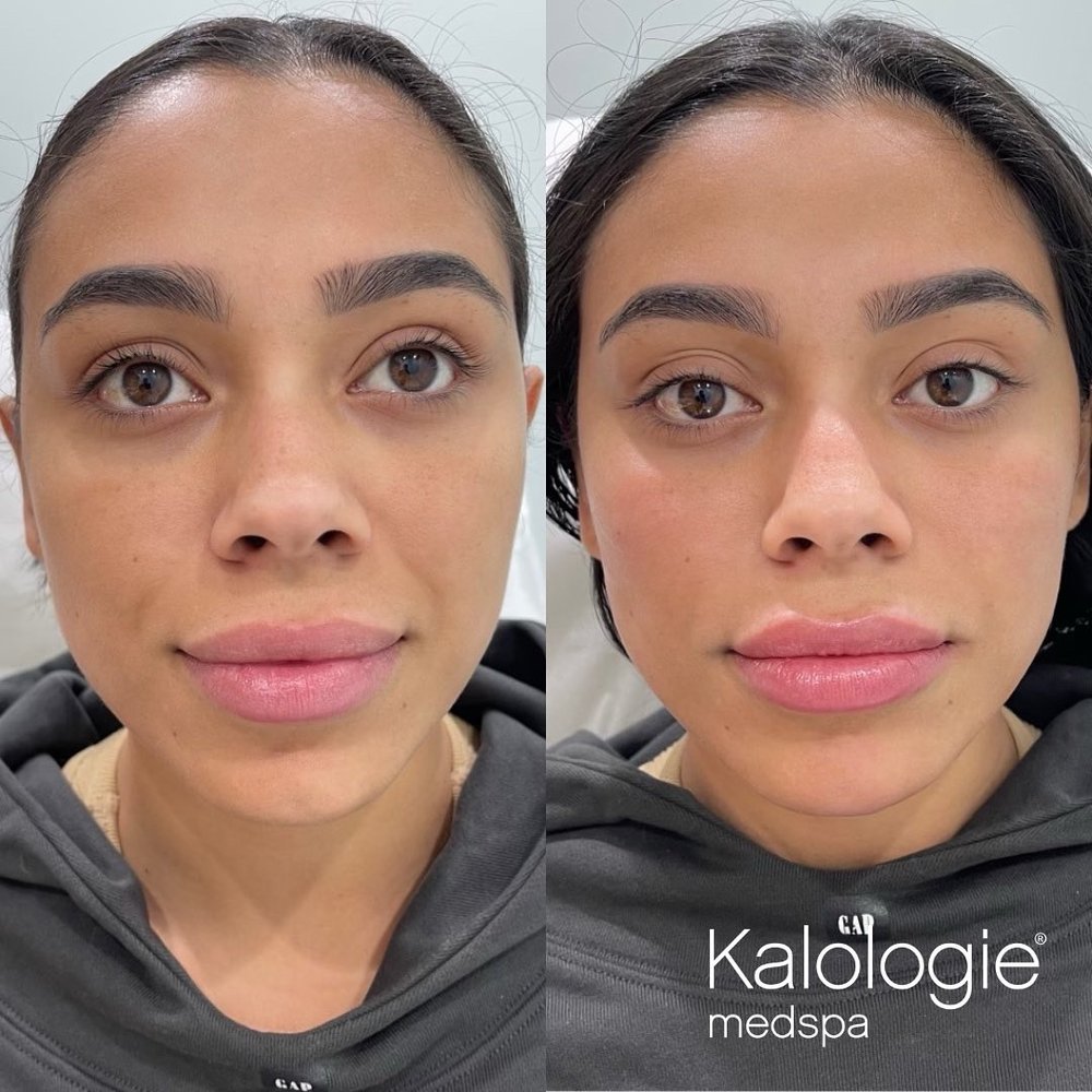 KALOLOGIE MEDSPA PARADISE VALLEY - Updated April 2025 - 24 Photos & 21 ...