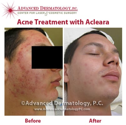 ADVANCED DERMATOLOGY - Updated October 2025 - 43 Reviews - 4 Technology ...