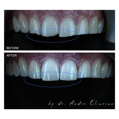 ANDRE ELIASIAN, DDS - ELITE DENTAL GROUP - Updated September 2025 - 83 ...