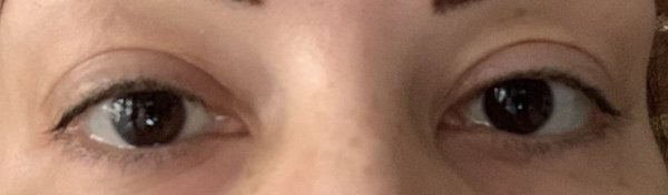 BARRY M WEINTRAUB, MD, New York, New York - 800A 5th Ave - Updated ...