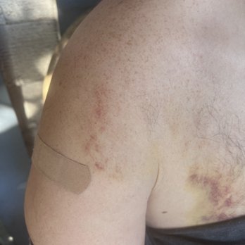 CANYON RIDGE HOSPITAL - Updated May 2024 - 26 Photos & 220 Reviews ...