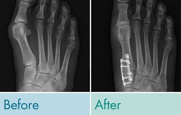 BRUCE I LERMAN, DPM - FOOT AND ANKLE MEDICAL GROUP - Updated May 2026 ...