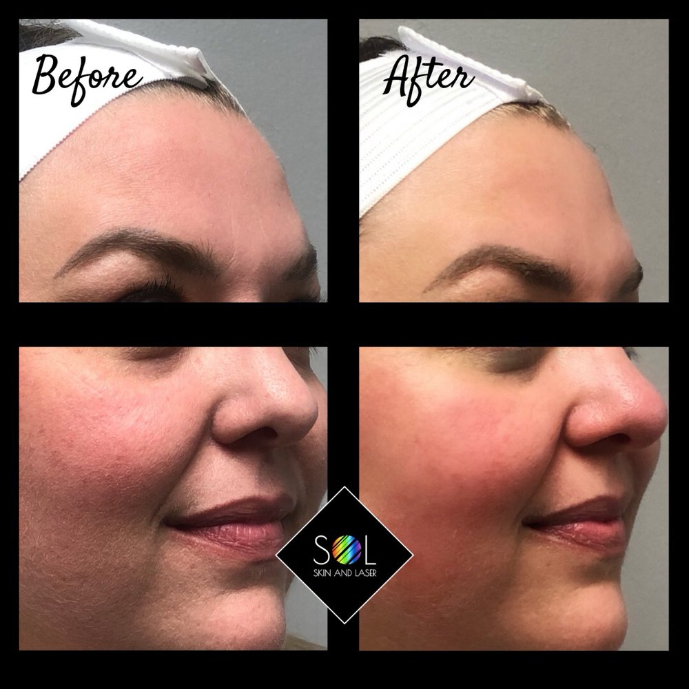 SOL SKIN & LASER - 11 Reviews - 9755 North 90th St, Scottsdale, AZ - Yelp