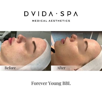 DVIDA MED SPA - Updated July 2025 - 160 Photos & 292 Reviews - 677 N ...