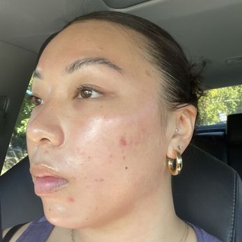 DERMASPACE - Updated December 2025 - 74 Photos & 178 Reviews - 509 ...