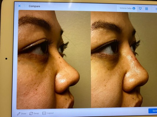 ALLURE ESTHETIC - Updated April 2025 - 59 Photos & 129 Reviews - 600 ...