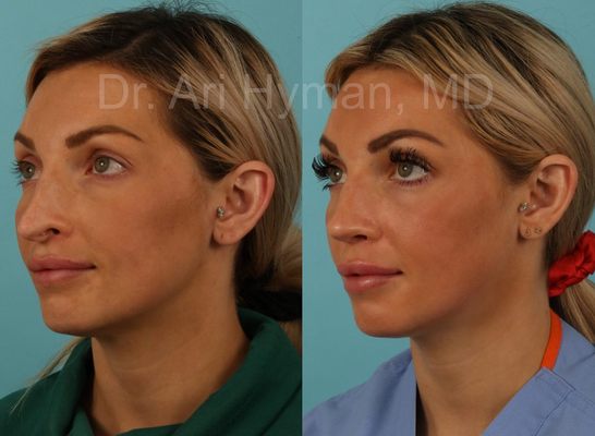 ARI HYMAN, MD - Updated October 2024 - 388 Photos & 57 Reviews - 16311 ...