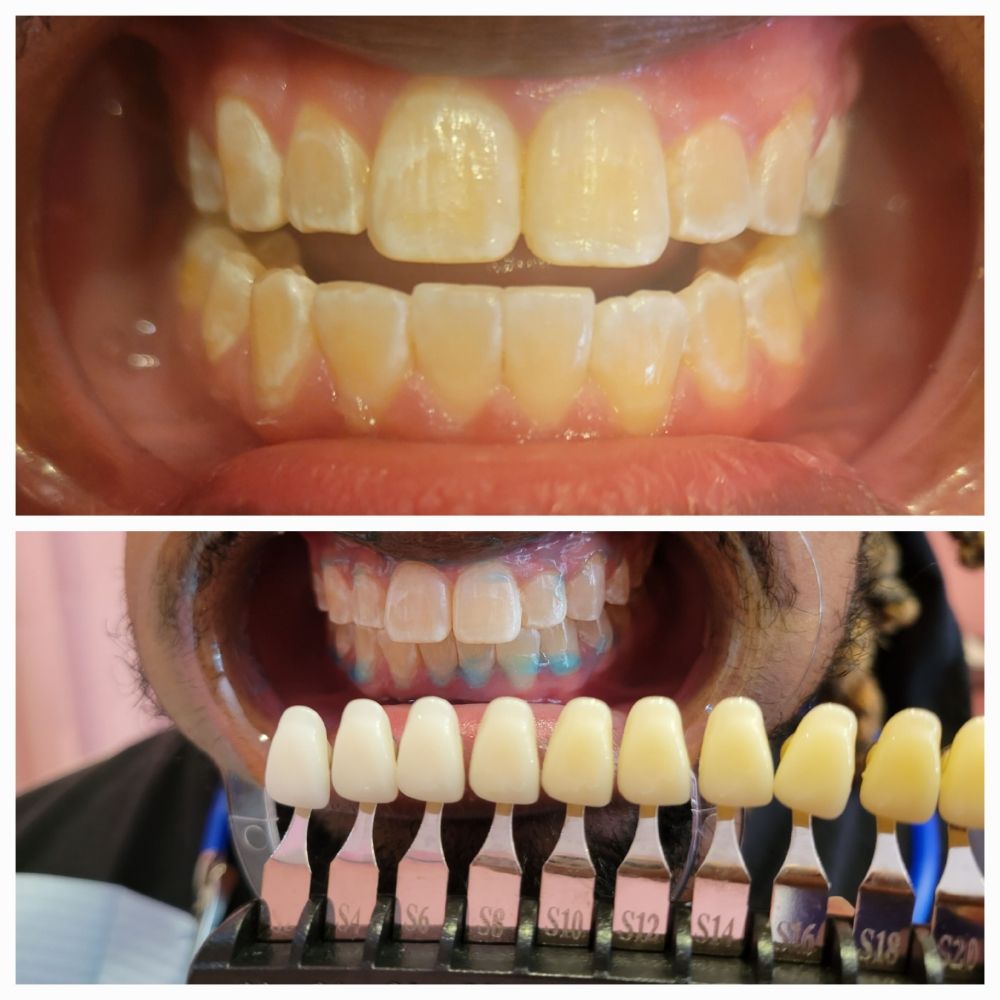 BLACK PEARL SMILES - Request an Appointment - Brooklyn, New York ...