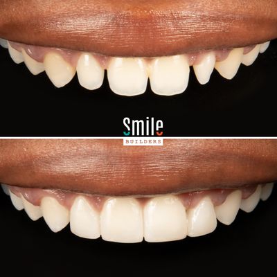SMILE BUILDERS - Updated October 2025 - 138 Photos & 114 Reviews - Av ...