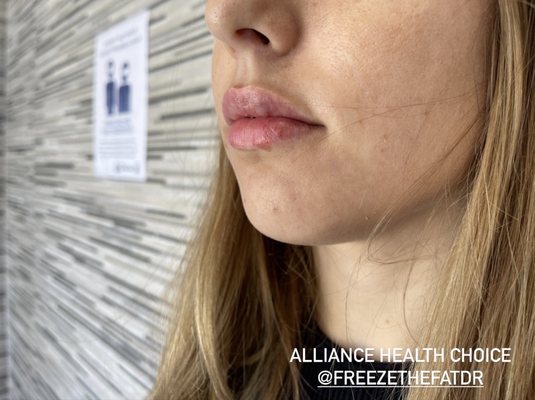 Alliance Health choice - Trusted Since 2015 - Updated July 2025 - 371 ...