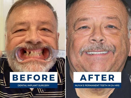 NUVIA DENTAL IMPLANT CENTER - Updated September 2025 - 26 Photos & 14 ...