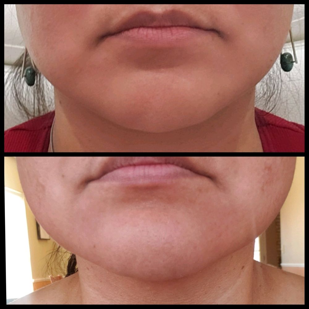 MW BODY ENHANCEMENTS - Updated February 2025 - El Paso, Texas - Body ...