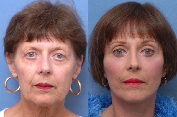 THE CHOE CENTER FOR FACIAL PLASTIC SURGERY - Updated August 2025 - 15 ...