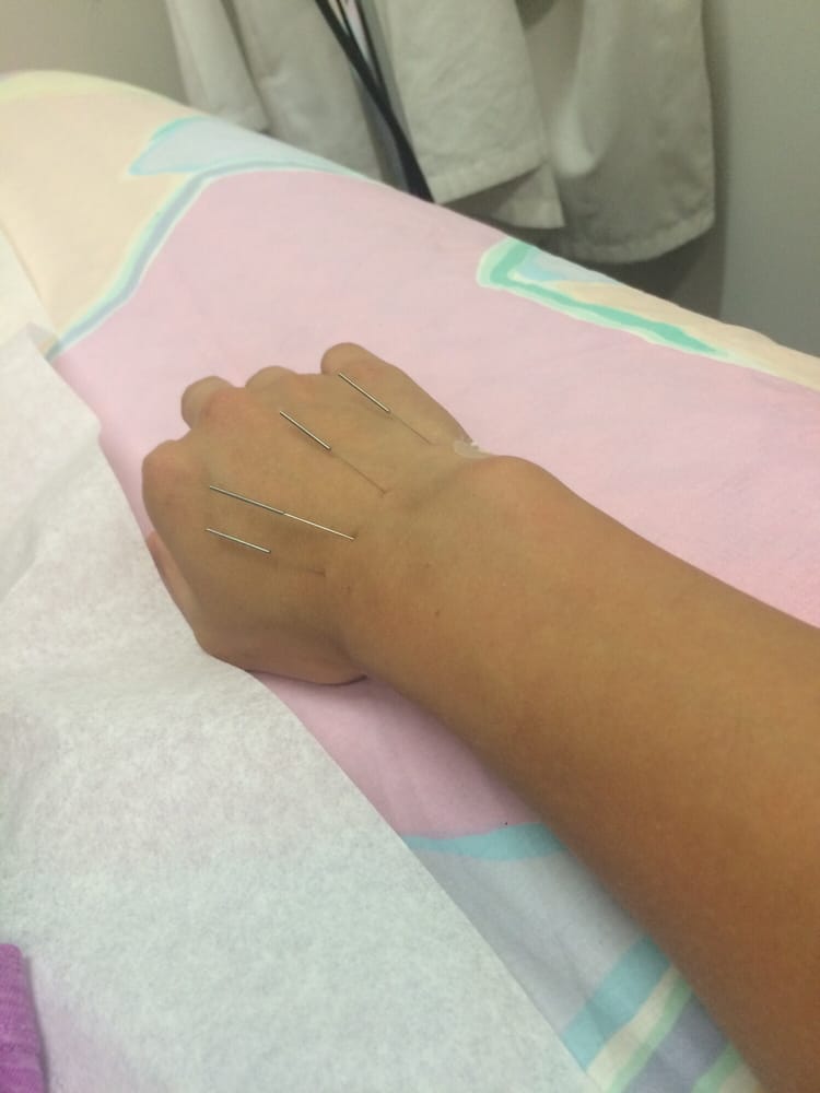 KIM’S ACUPUNCTURE - Updated January 2026 - 4055 Wilshire Blvd, Los ...