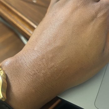 DUPURE - Updated January 2026 - 39 Photos & 179 Reviews - 11321 ...