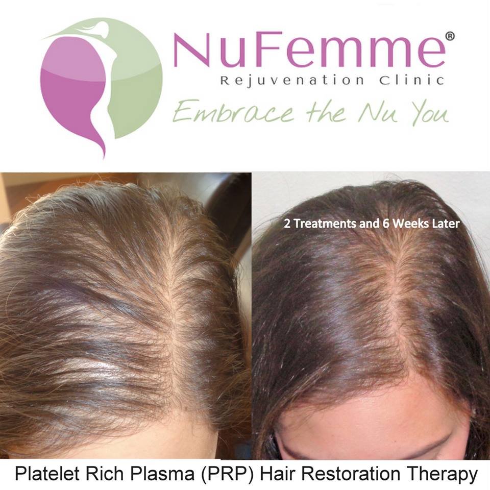 NUFEMME REJUVENATION CLINIC - MILWAULKEE - Updated December 2025 - 19 ...