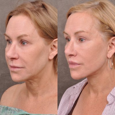 BEN TALEI, MD - Updated May 2024 - 203 Photos & 192 Reviews - 465 N ...