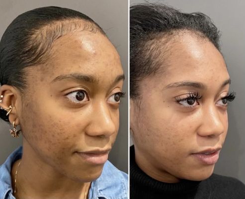 REGEN RX THERAPY - Updated December 2025 - 39 Photos - 3134 E ...