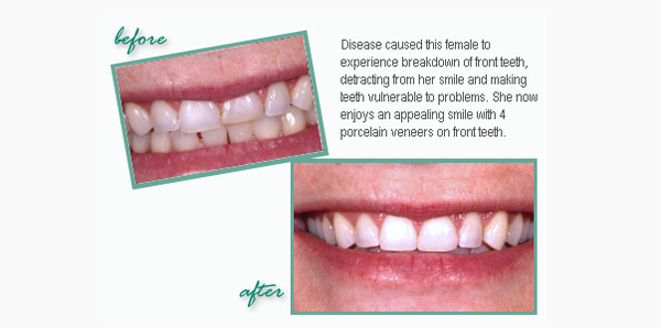 DAVID A RICE, DDS - Updated October 2025 - 38 Photos & 24 Reviews ...