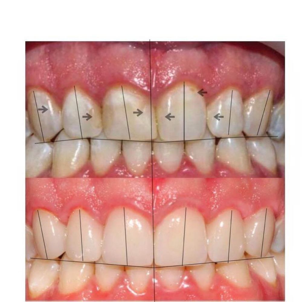 LUMINOUS SMILES - 49 Photos & 58 Reviews - 180 Newport Center Dr ...