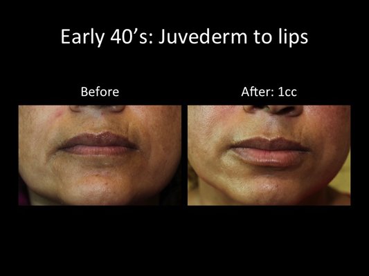 LAFACE BY LAURA PHAN, MD - Updated January 2026 - 35 Photos & 64 ...