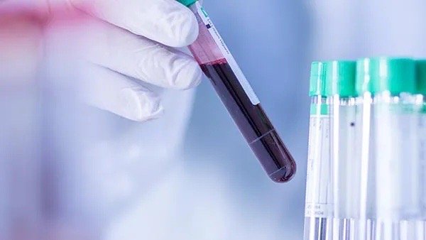 UTSW HOSPITAL OUTPATIENT LABORATORY - Updated December 2025 - 5959 ...