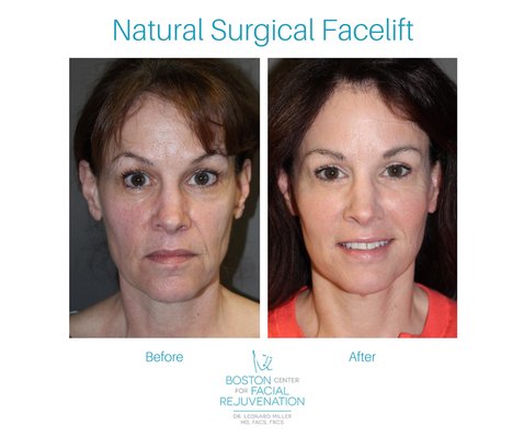 BOSTON CENTER FOR PLASTIC SURGERY - Updated May 2026 - 102 Photos & 23 ...