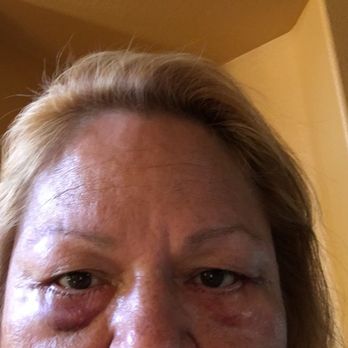 LILY LEE, MD - Updated December 2025 - 41 Photos & 15 Reviews - 73-180 ...