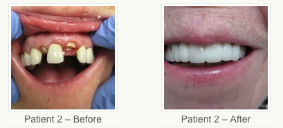 ACCENT DENTAL - Updated October 2025 - 14 Photos & 16 Reviews - 8300 ...