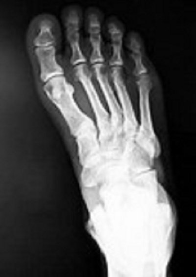 SHANE D RHODES, DPM FACFAS - Updated January 2026 - 25078 Peachland Ave ...