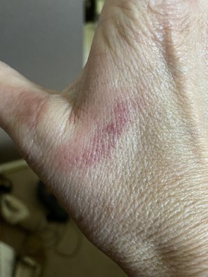 COMMONSPIRIT PENROSE HOSPITAL - Updated March 2025 - 28 Photos & 123 ...