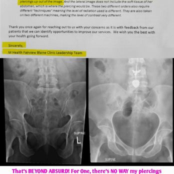 FAIRVIEW CLINICS - BLAINE - Updated December 2025 - 11 Photos - 10961 ...