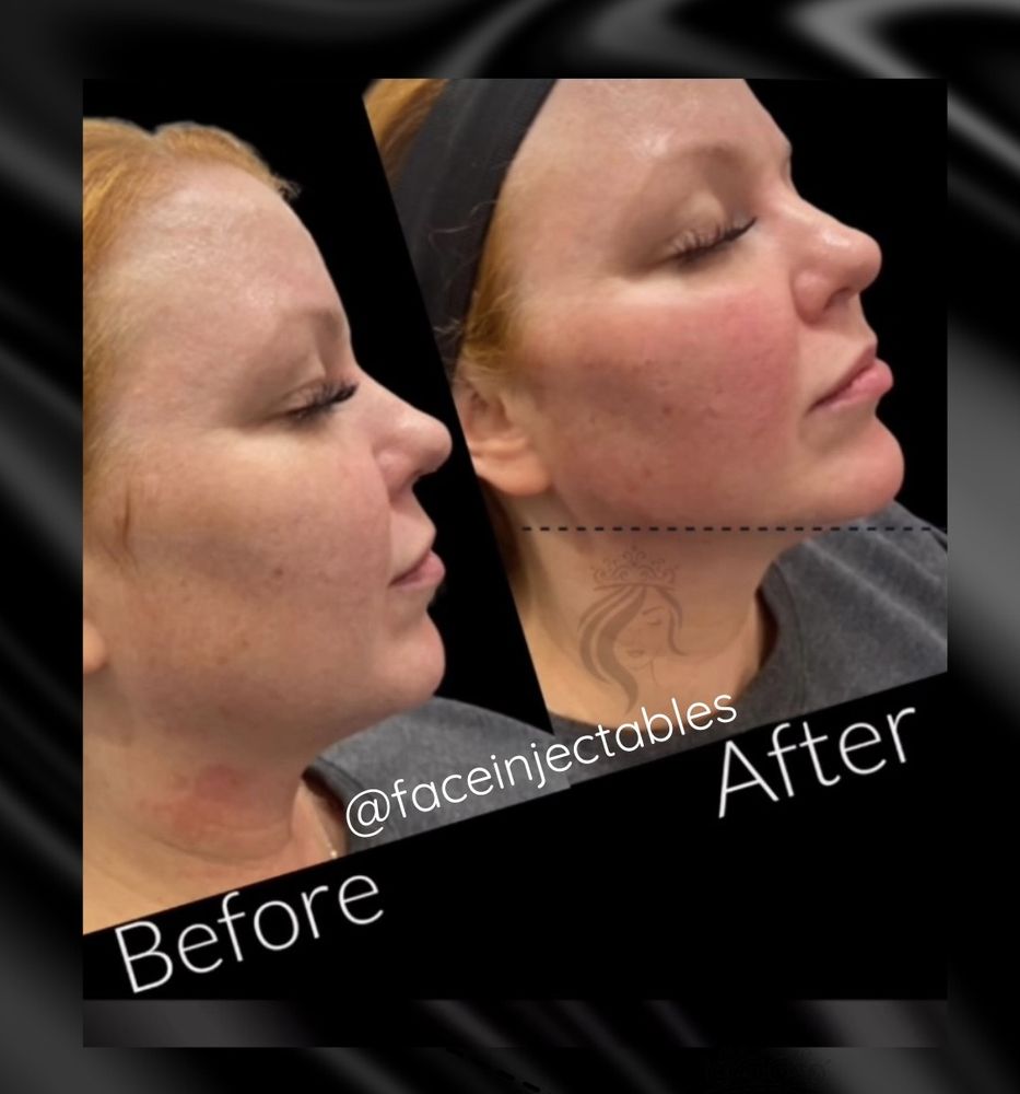 FACE INJECTABLES - Updated November 2024 - 19 Photos - 10 Strada Drive ...