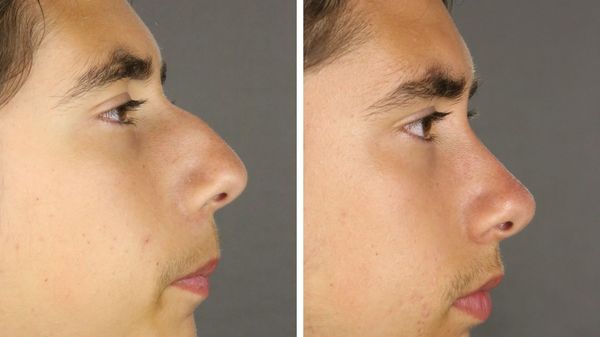 DAVID A NEWMAN, MD FACS - NEWMAN TEMECULA PLASTIC SURGERY - Updated ...