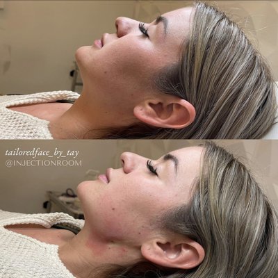 THE INJECTION ROOM - Updated December 2025 - 25 Photos & 14 Reviews ...