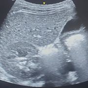 OPTUM - SMOKEY POINT WALK-IN CLINIC - Updated August 2025 - 2901 174th ...