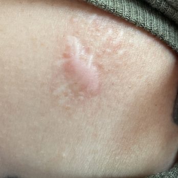 BUCKEYE DERMATOLOGY - Updated December 2025 - 13 Reviews - 825 S Watson ...