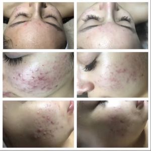 LATINA MED SPA - 32 Photos & 39 Reviews - Skin Care - 5950 Santa Fe Ave ...