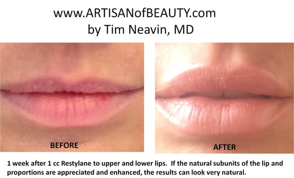 TIM NEAVIN - Updated December 2025 - 56 Photos & 46 Reviews - 421 N ...