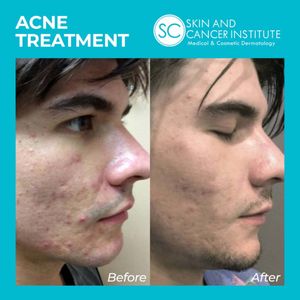 SKIN AND CANCER CENTER OF ARIZONA - Updated April 2025 - 92 Reviews ...