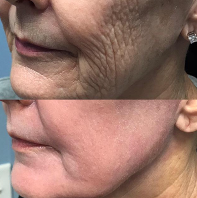 MIDSTATE SKIN INSTITUTE - Updated April 2025 - 34 Photos & 13 Reviews ...