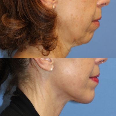 EVAN RANSOM, MD - Updated December 2025 - 126 Photos & 241 Reviews ...