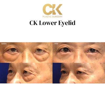 CK PLASTIC SURGERY - 213 Photos & 102 Reviews - 2970 W Olympic Blvd ...