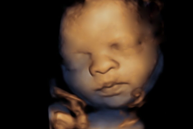 BABY IN SIGHT 3D/4D FETAL ULTRASOUND - Updated November 2024 - 31 ...
