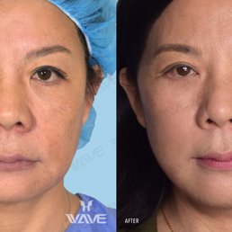 Wave Plastic Surgery Reviews | Read Customer Service Reviews of ...