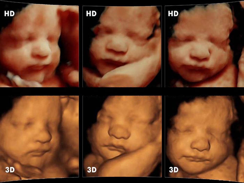 3D 4D ULTRASOUND BY 4D SPECIAL DELIVERY - Updated October 2024 - 30 ...